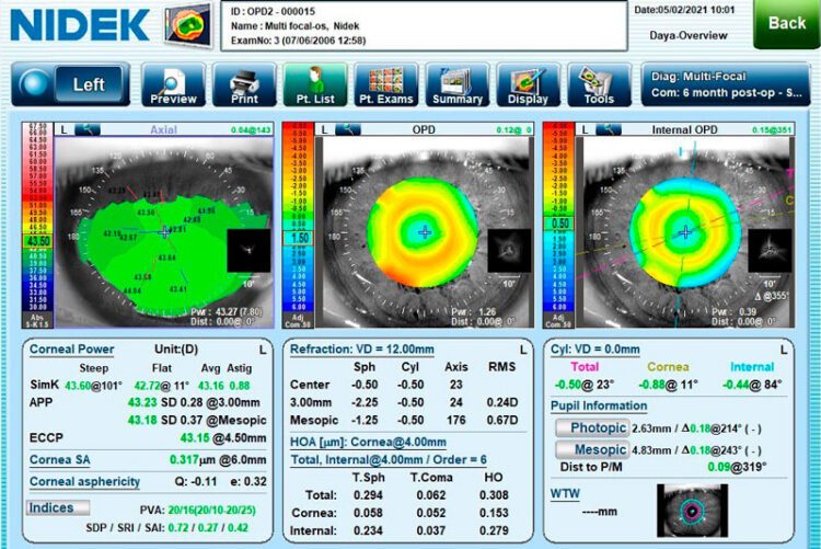 Nidek presenta el OPD-Scan III – Oftalmólogo al Día
