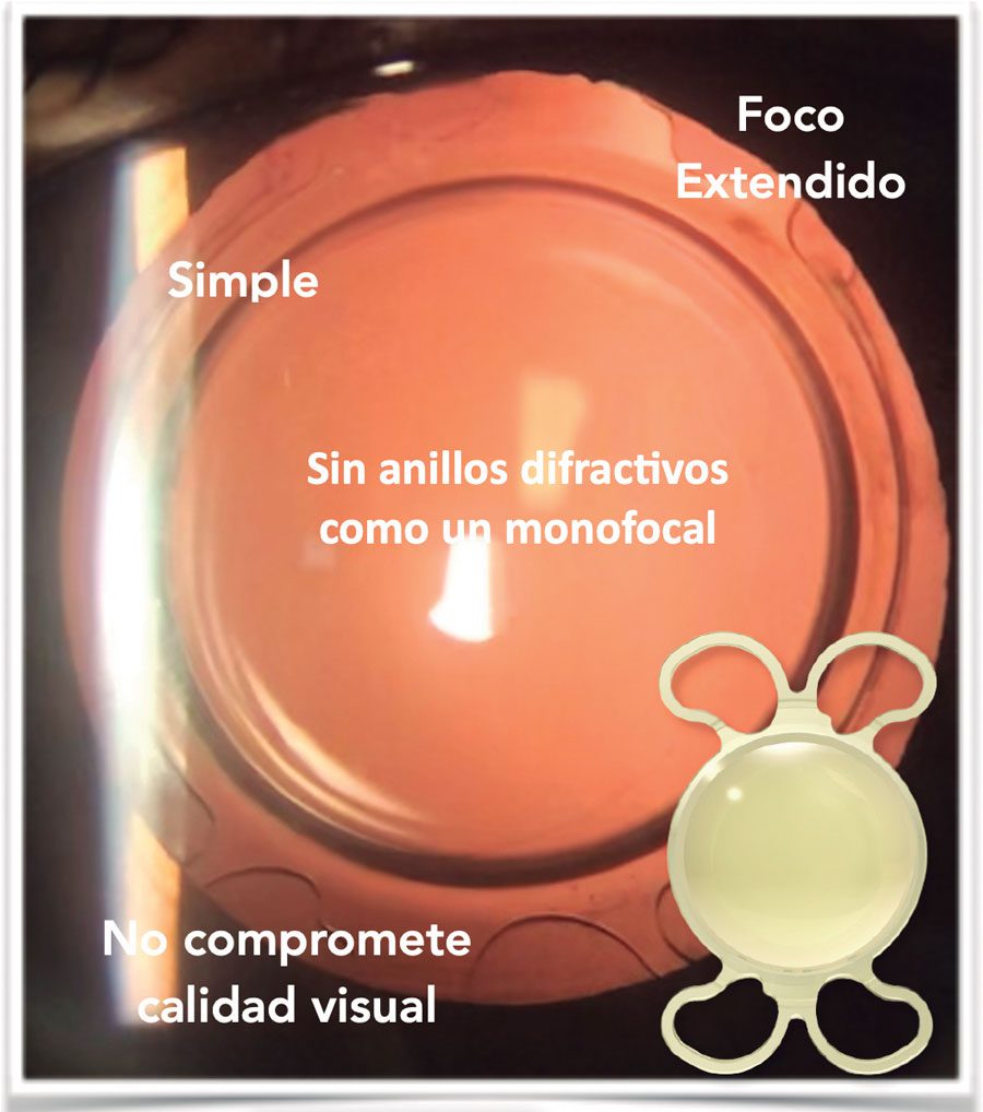 ¿Por qué ISOPURE? – Oftalmólogo al Día