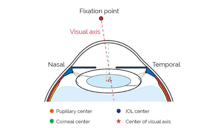 Los mejores papers del tercer cuatrimestre del 2022 – Oftalmólogo al Día