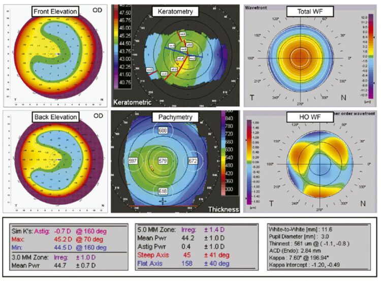 Los mejores papers del tercer cuatrimestre del 2022 – Oftalmólogo al Día