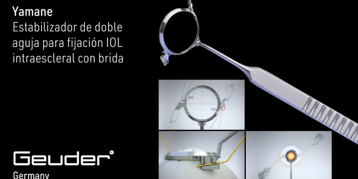 Campimetro computarizado | Octopus 900 | Perimetría de goldmann ...