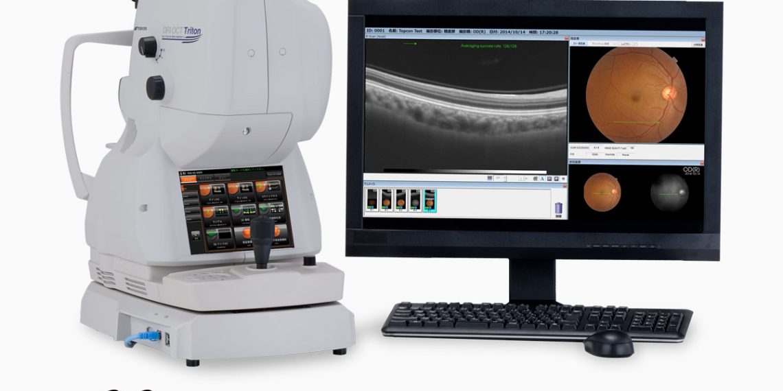 Campimetro computarizado | Octopus 900 | Perimetría de goldmann ...